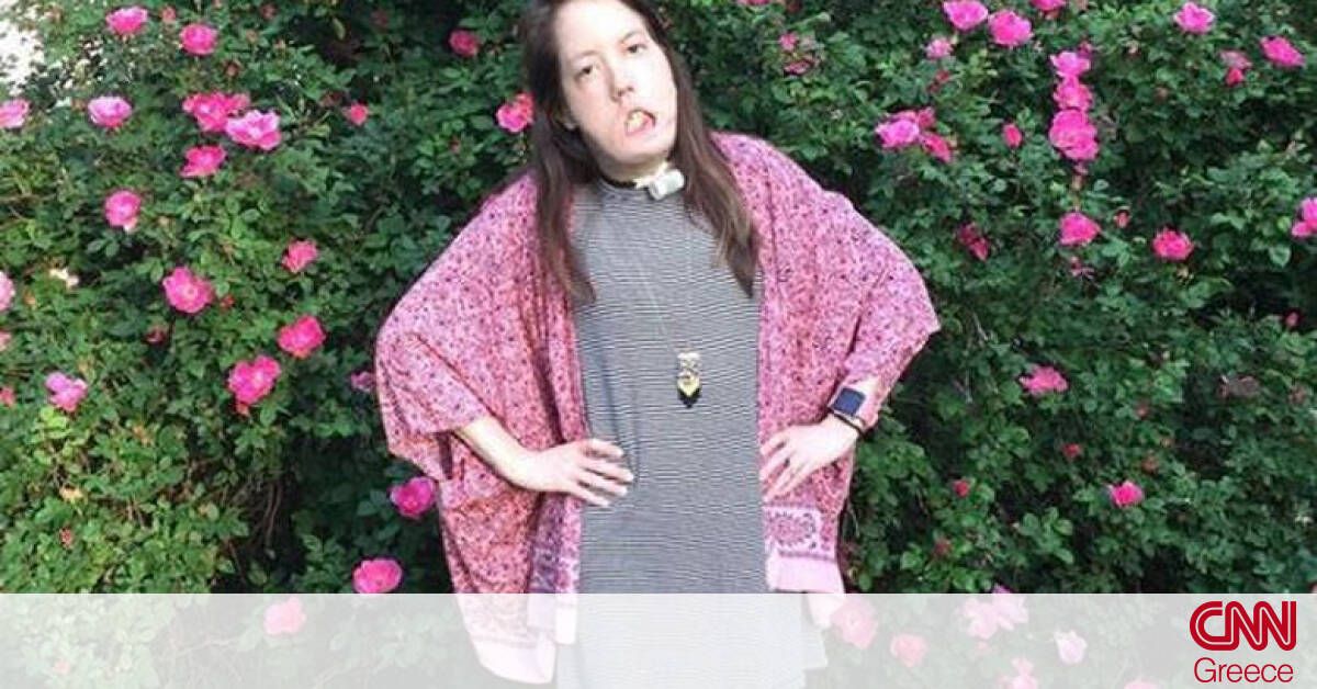 ΗΠΑ: Γυναίκα δεν μπορεί να κλείσει τα μάτια και το στόμα της μετά από ...