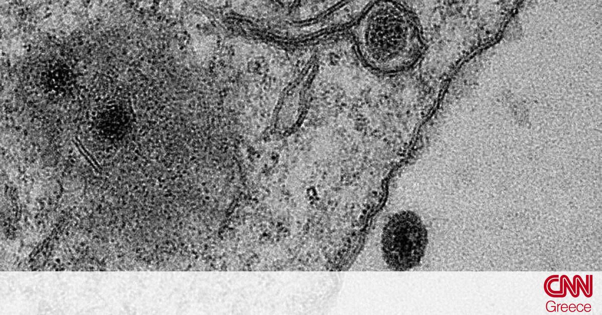 Yaravirus: Νέος μυστηριώδης ιός προβληματίζει τους επιστήμονες - CNN.gr