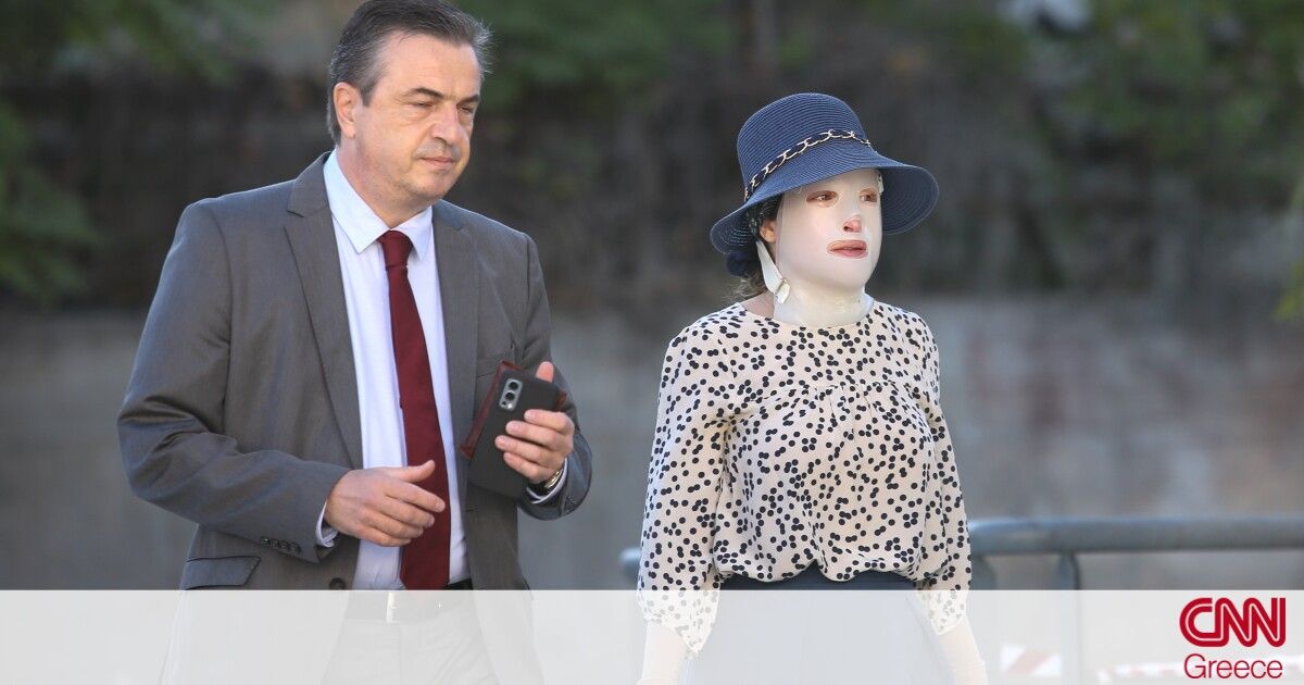 Δίκη για βιτριόλι - Πλαστικός χειρουργός της Ιωάννας: «Θα μπορούσε να ...
