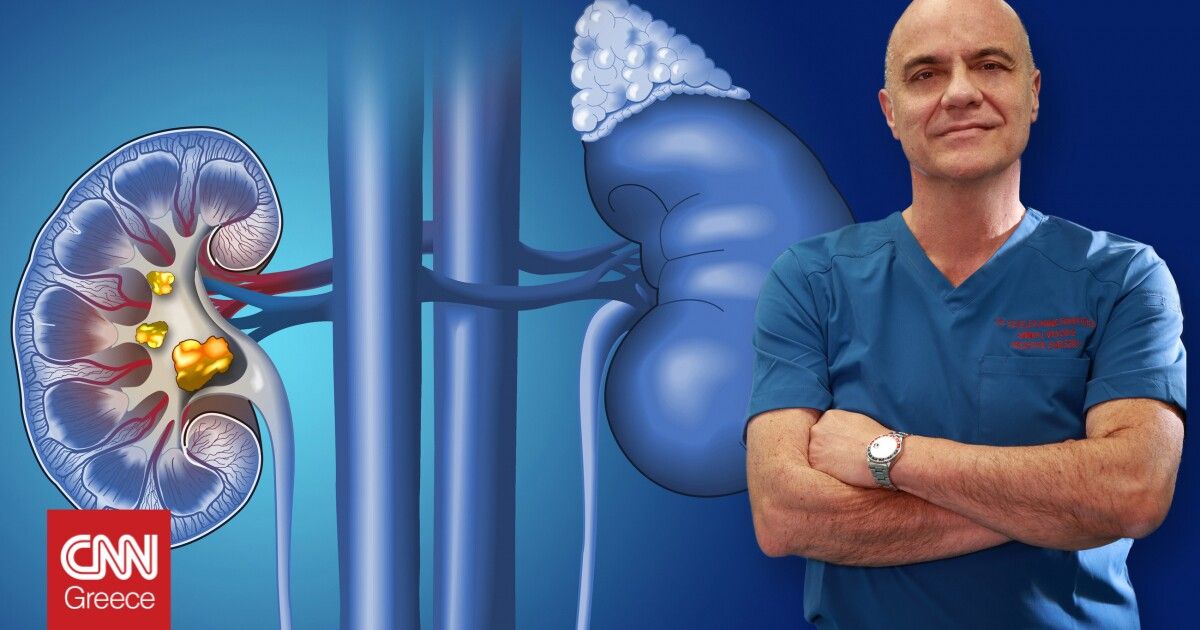 Επαναστατική εξέλιξη στην ουρολογία με τεχνολογία moses laser - CNN.gr