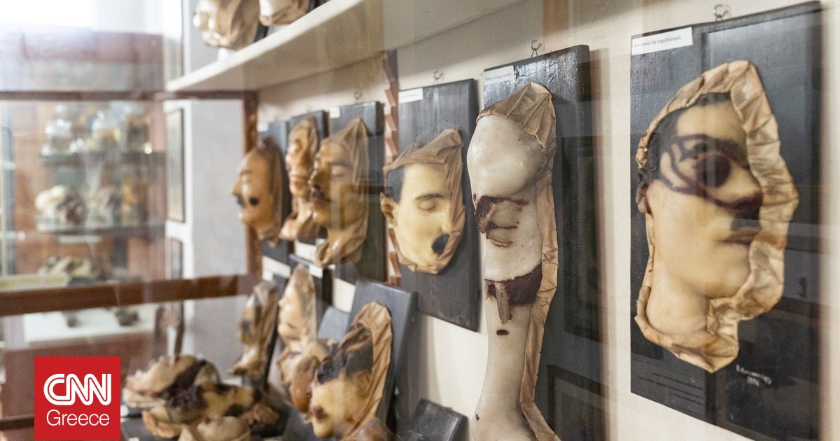 Οι φρικιαστικοί θησαυροί του Εγκληματολογικού Μουσείου: Από την ...