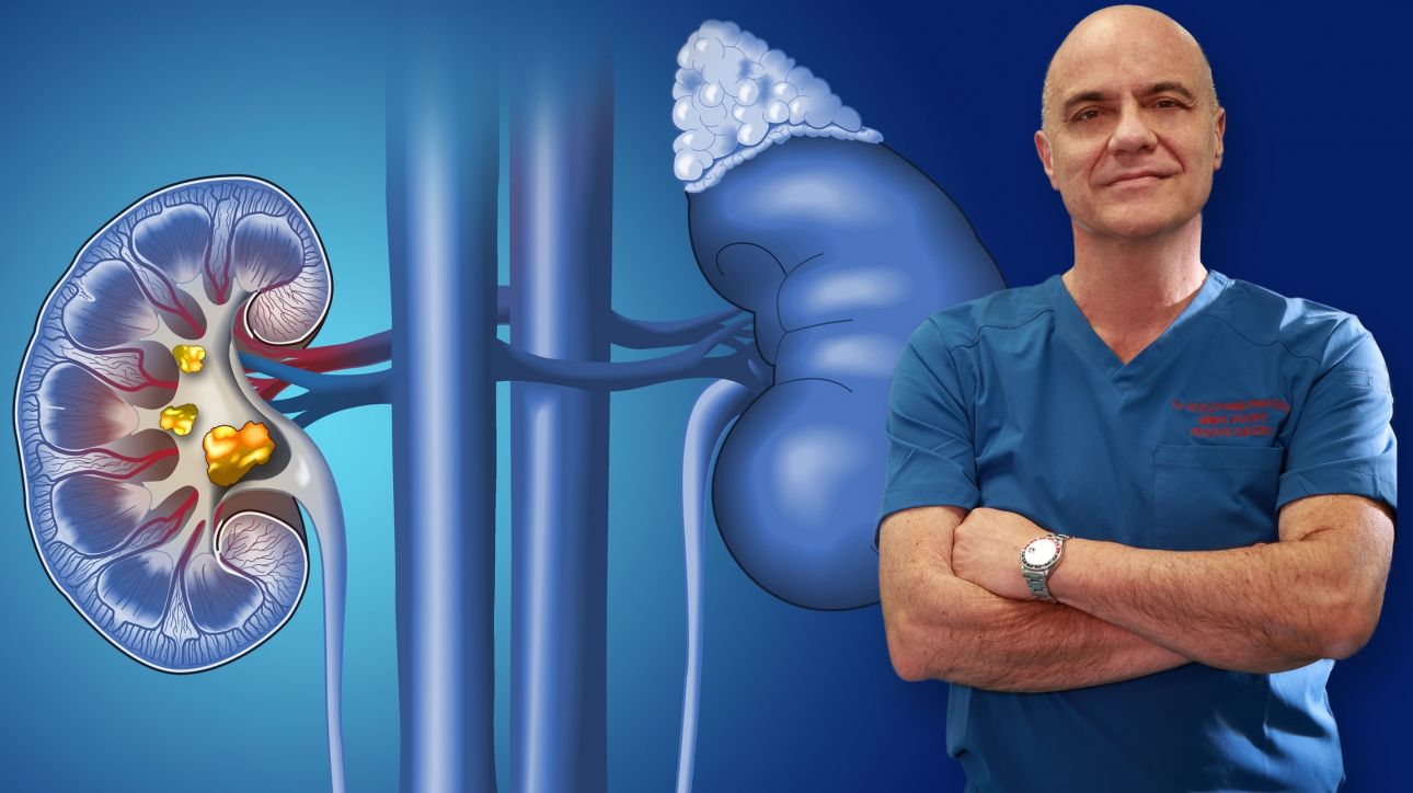 Επαναστατική εξέλιξη στην ουρολογία με τεχνολογία moses laser - CNN.gr